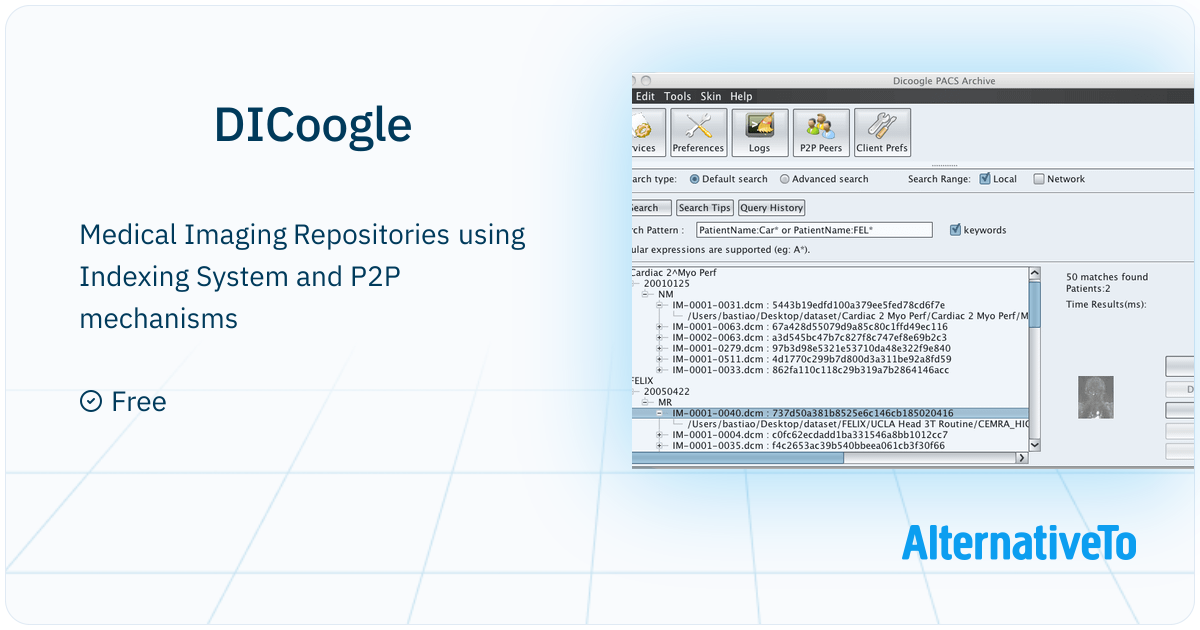 DICoogle: Medical Imaging Repositories using Indexing | AlternativeTo