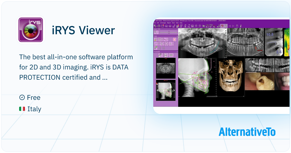 iRYS Viewer: IRYS is a highly advanced desktop software for dental ...